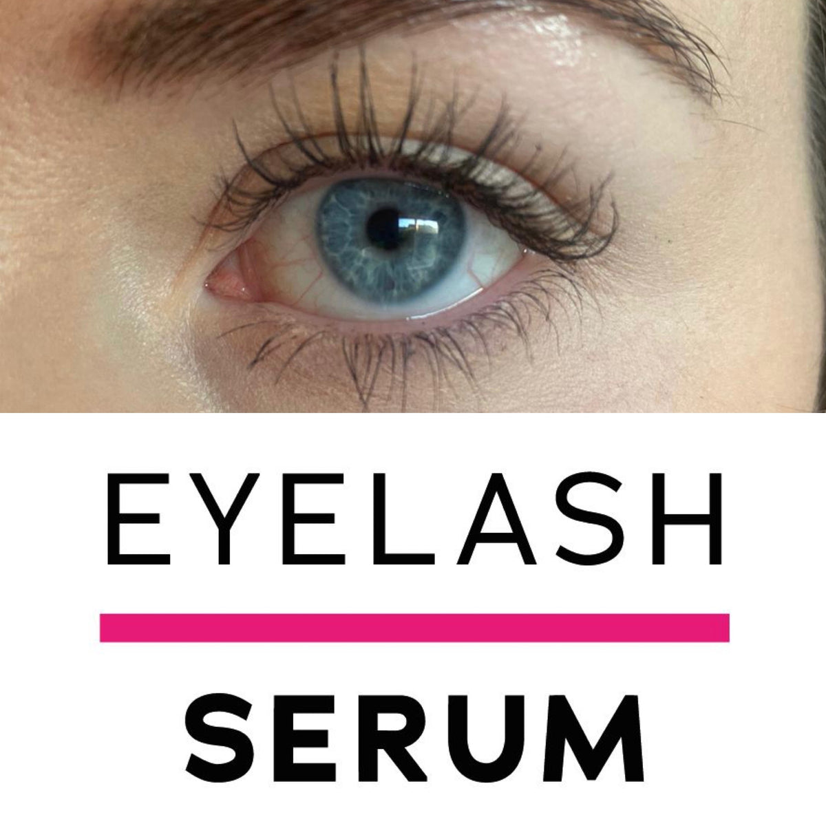 Eyelash Serum – Lash Famous